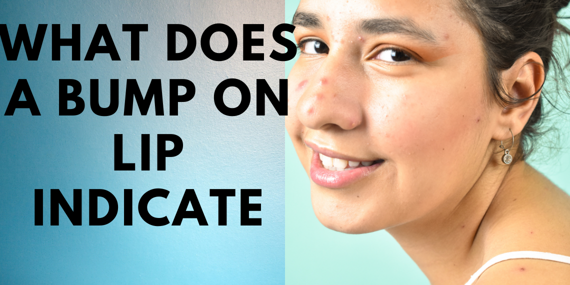 What Does A Bump On Lip Indicate What Causes Them How To Cure Them Mousetimes